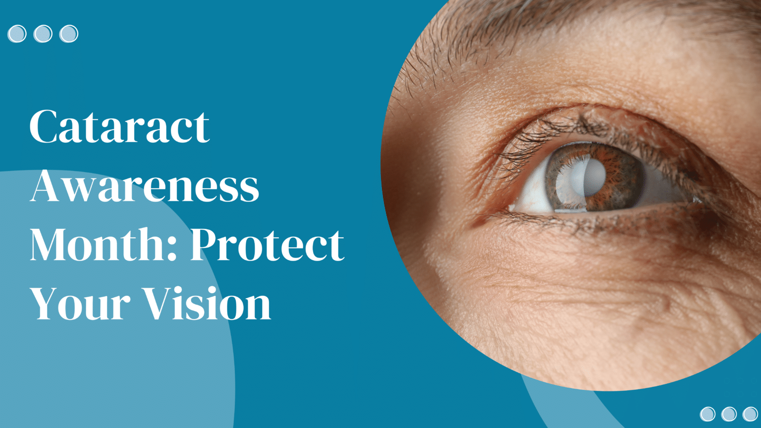 Cataract Awareness Month: Protect Your Vision | Southwest Eye Care